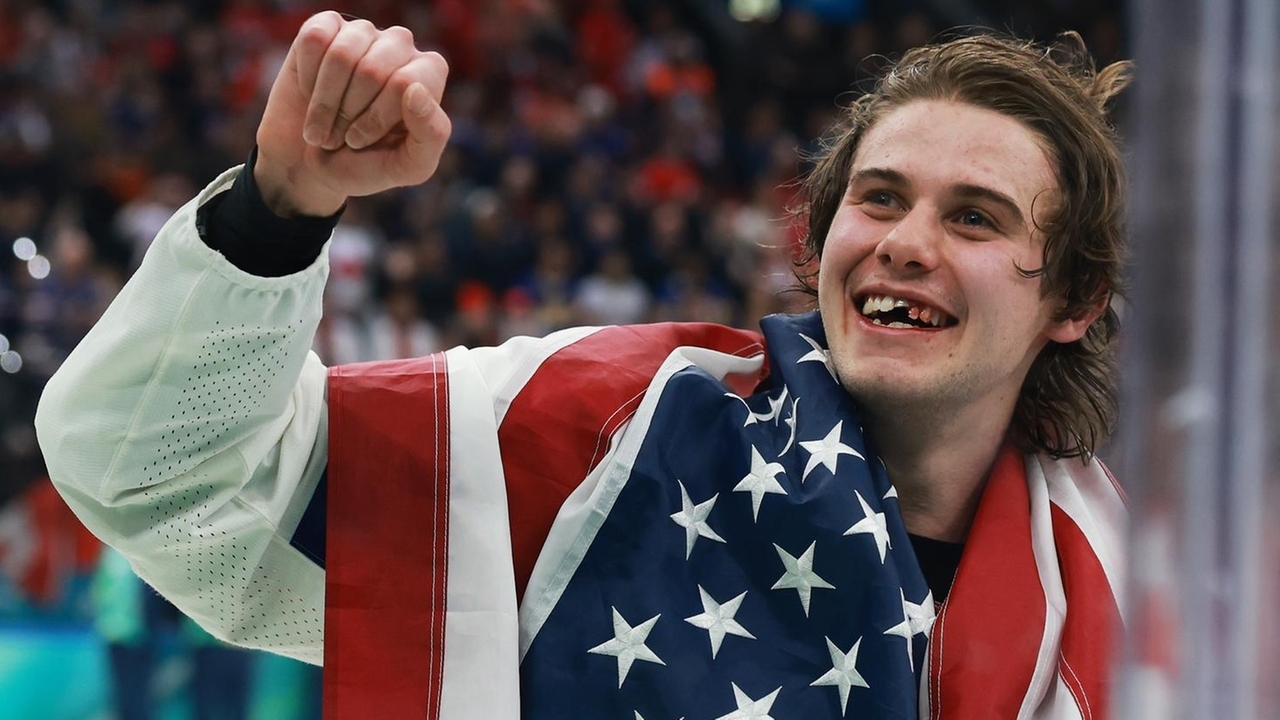 Spittin' chiclets: What happens when hockey players lose their teeth ...
