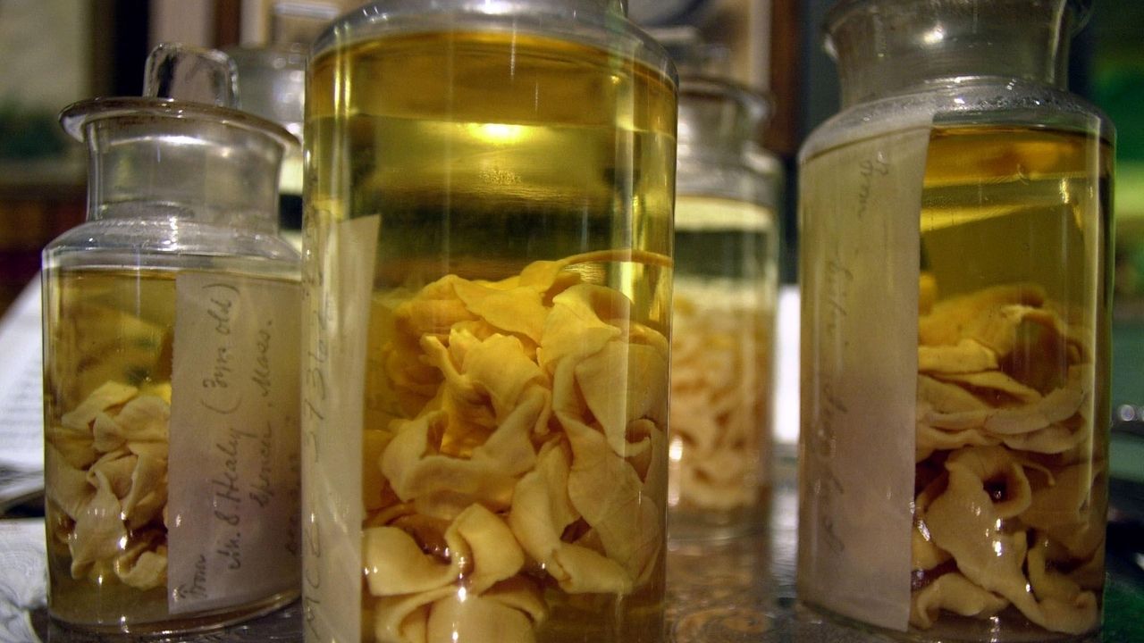 Tapeworms: A diet plan with a long list of health risks - Newsday