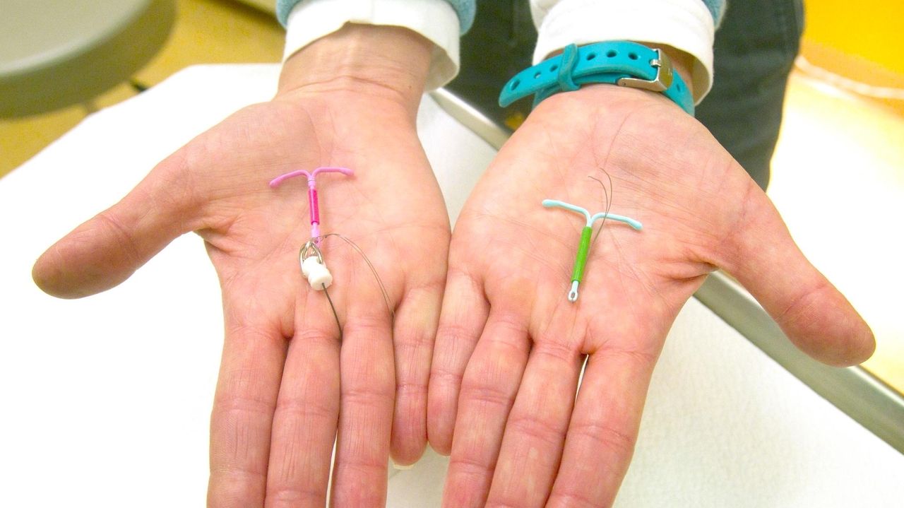 It's not just IUDs. Gynecologists and patients are focused on making ...