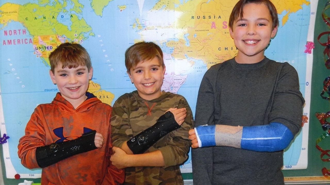 How I broke my arm: 3 LI boys tell their story - Newsday