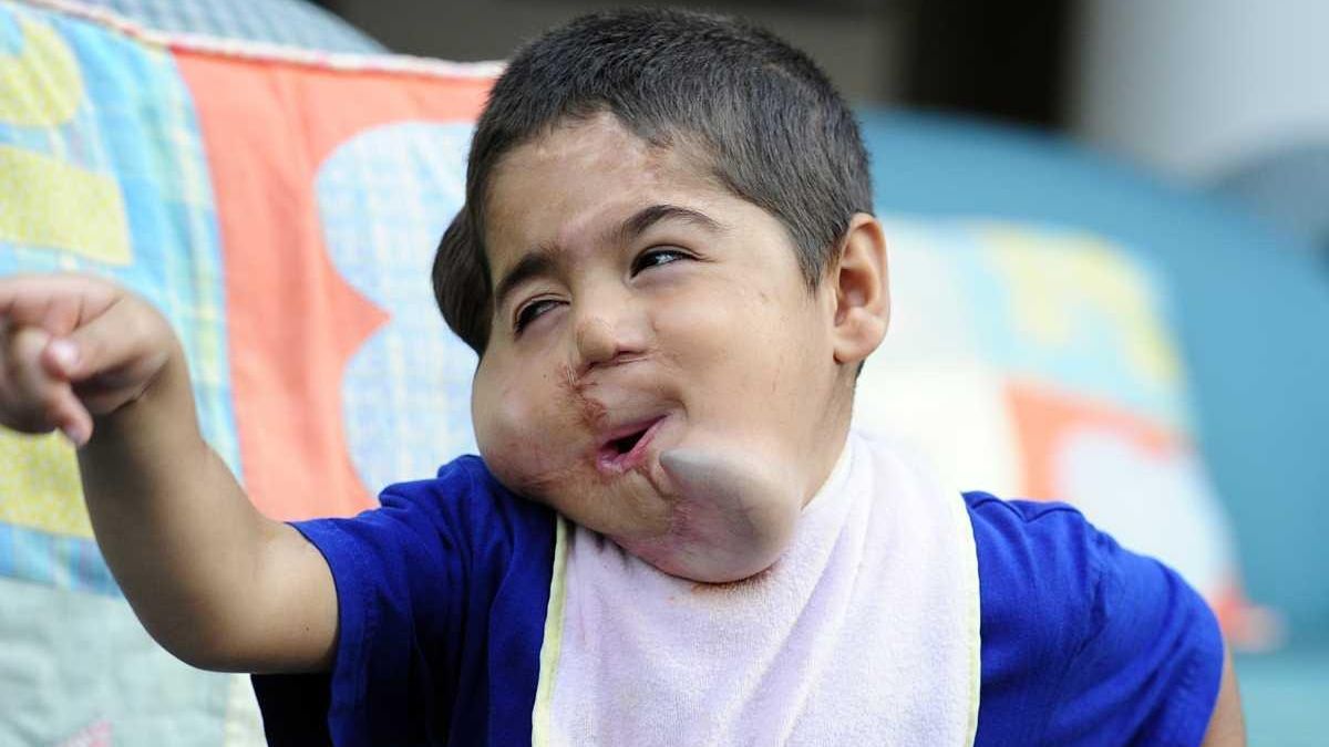 Iraqi bomb victim, 4, gets help on LI - Newsday