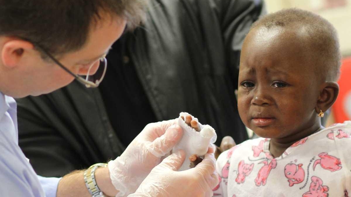 LI doctors help heal West African girl - Newsday