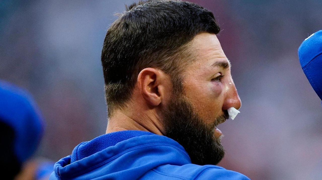 Mets outfielder Kevin Pillar undergoes surgery to repair his badly broken nose - Newsday