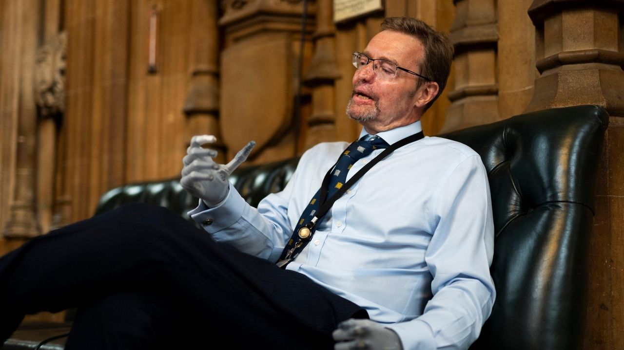 A UK lawmaker returns to work as 'the bionic MP' after losing his hands ...