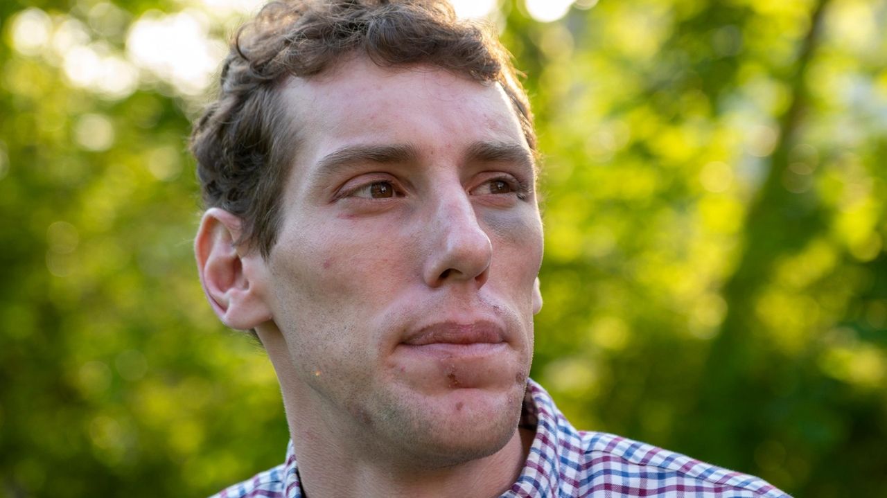 3 plead guilty to roles in 2021 attack on Lawrence man during pro ...