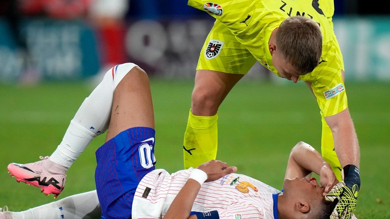 Kylian Mbappé due for tests on his broken nose as France gets 'positive ...